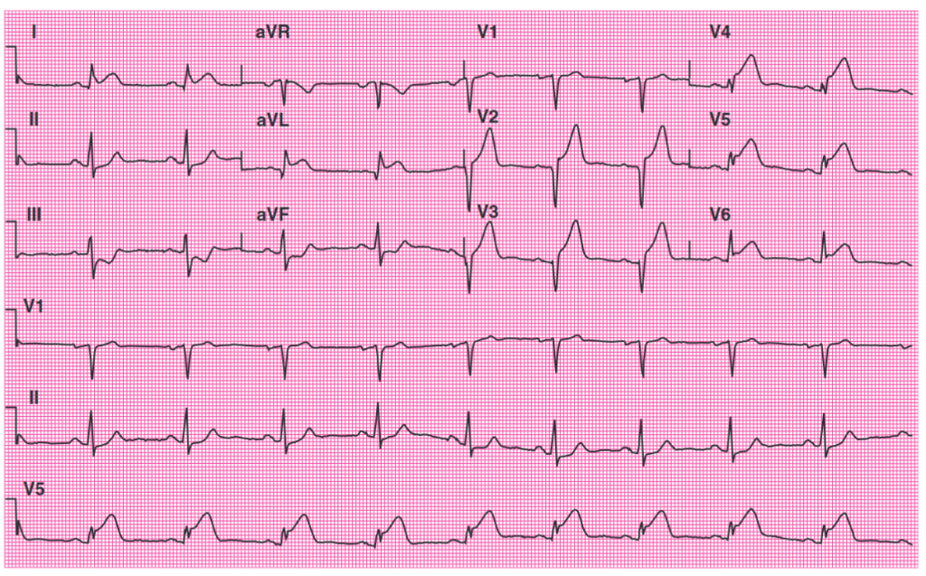 ACLS Precourse Self Assessment Answers - Driving Theory Course Prep
